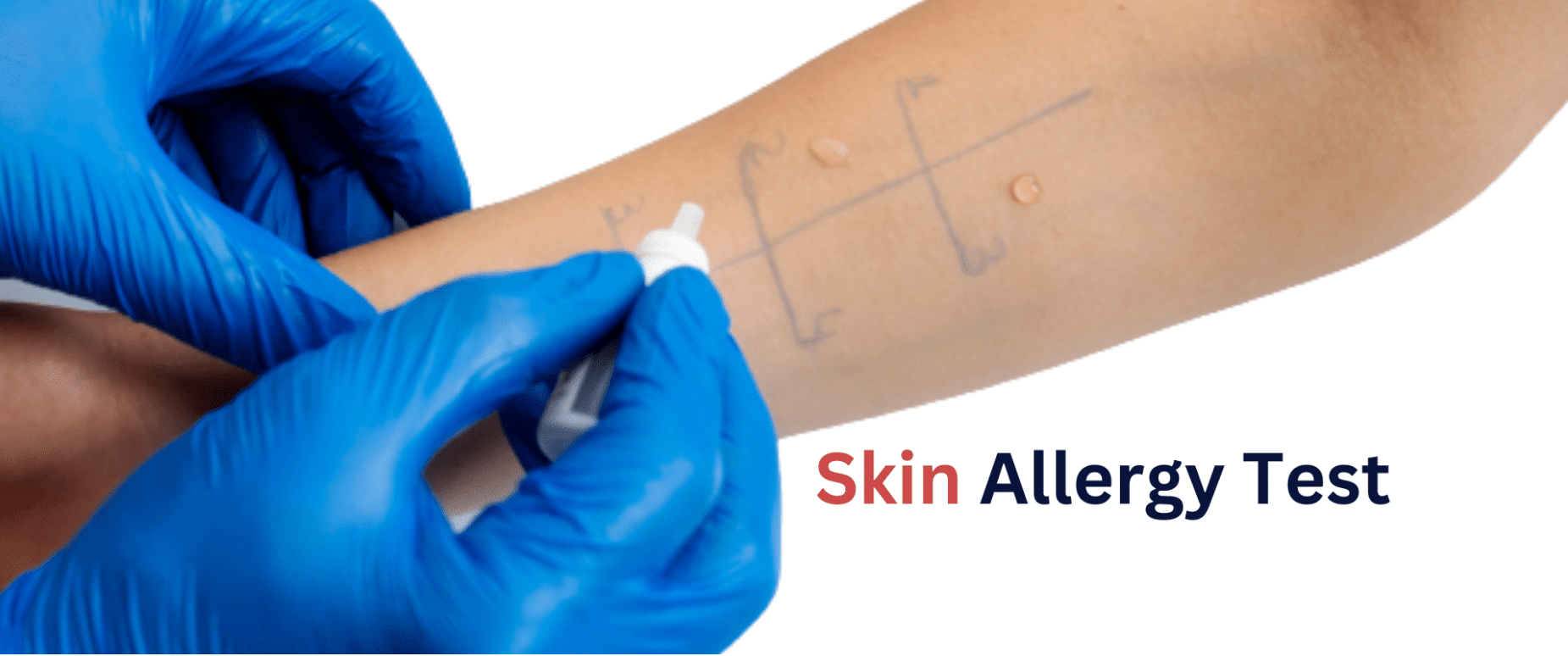 Allergy Testing & Desensitisation | Family Doctor